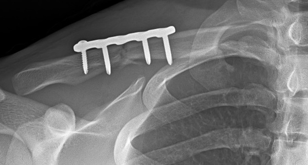 Dr. Steven Chudik, Orthopaedic Surgery and Sports Medicine Teaching and ...