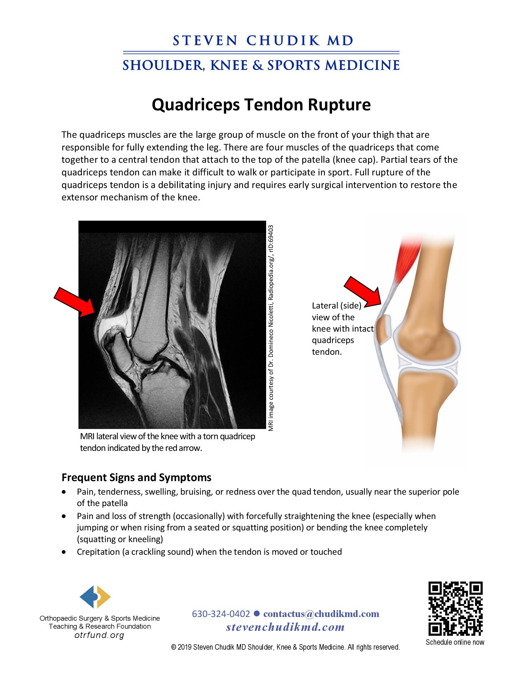 Quadriceps Tendon Anatomy Quadriceps Tendon Anatomy
