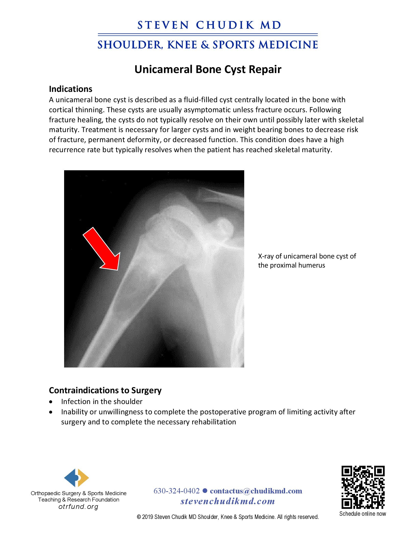 Unicameral Bone Cyst Repair - Steven Chudik MD