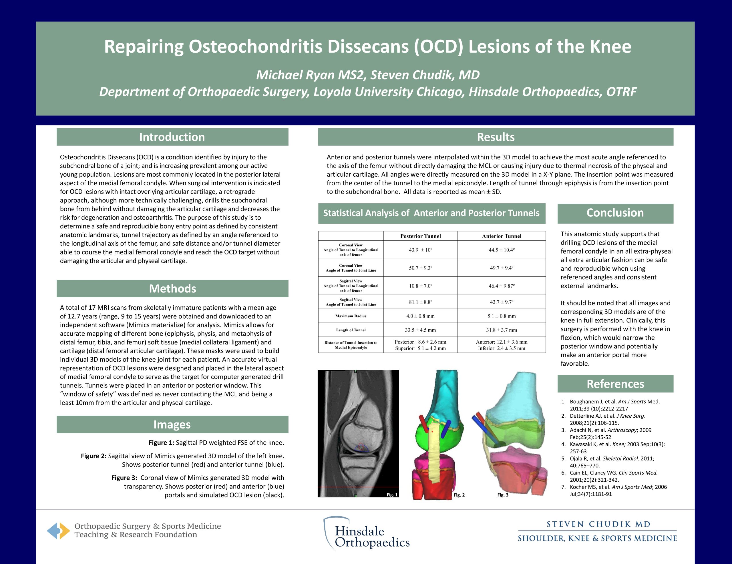 Osteochondritis Dissecans Of The Elbow: Recent Evolution Of, 41% OFF