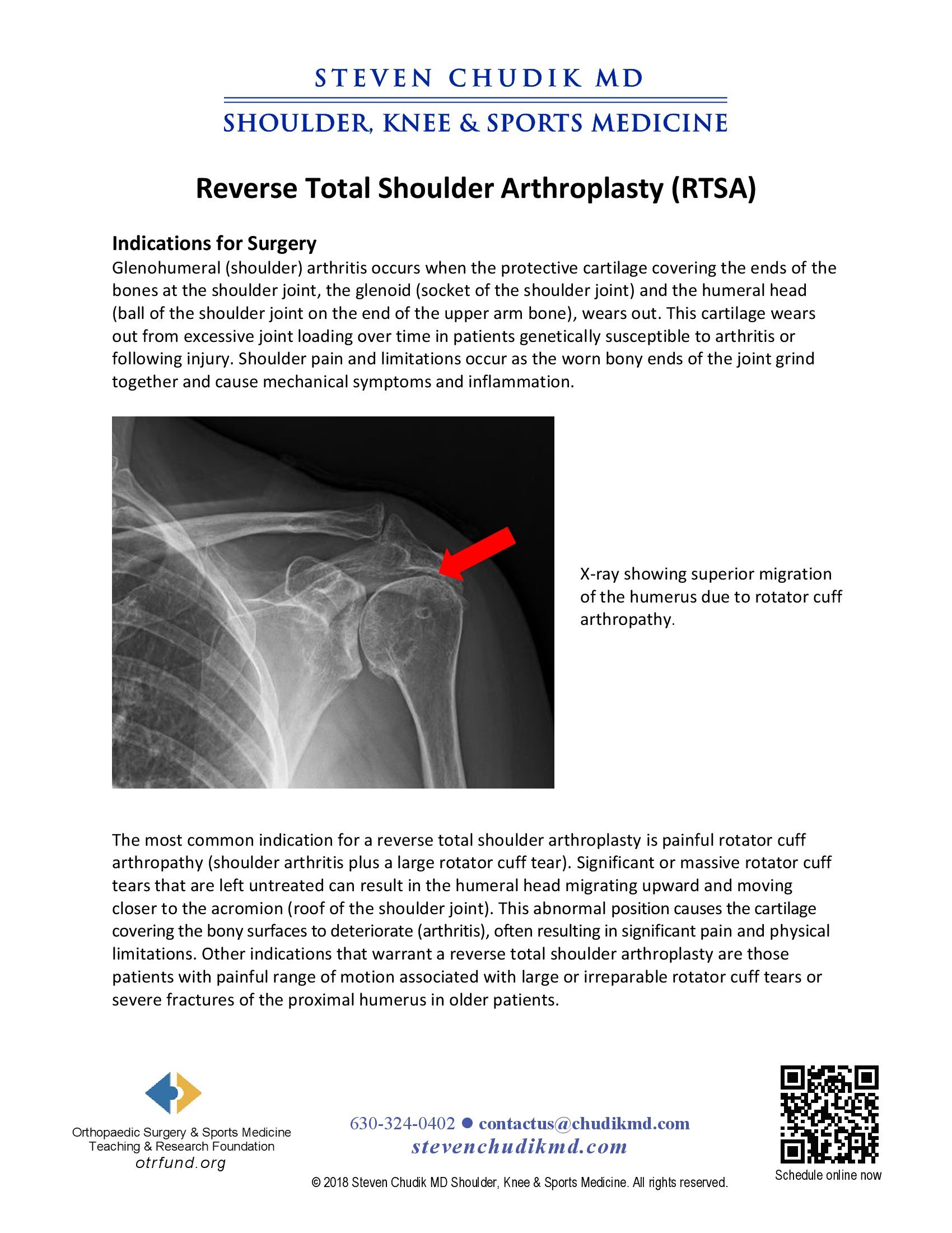 Reverse Total Shoulder Arthroplasty - Steven Chudik MD