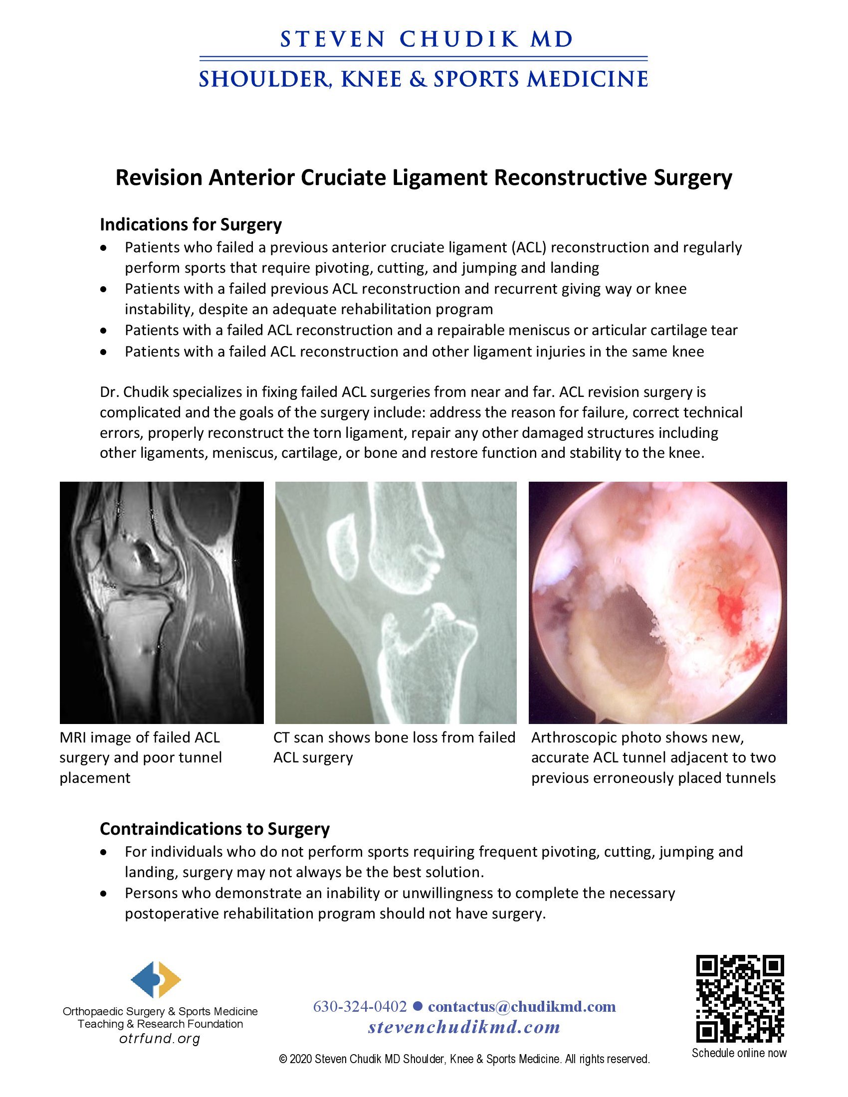 Revision Anterior Cruciate Ligament Reconstructive Surgery - Steven ...